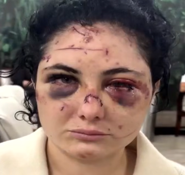 Homeless Man Accused Of Stabbing Woman Outside Miami Condo - The ...